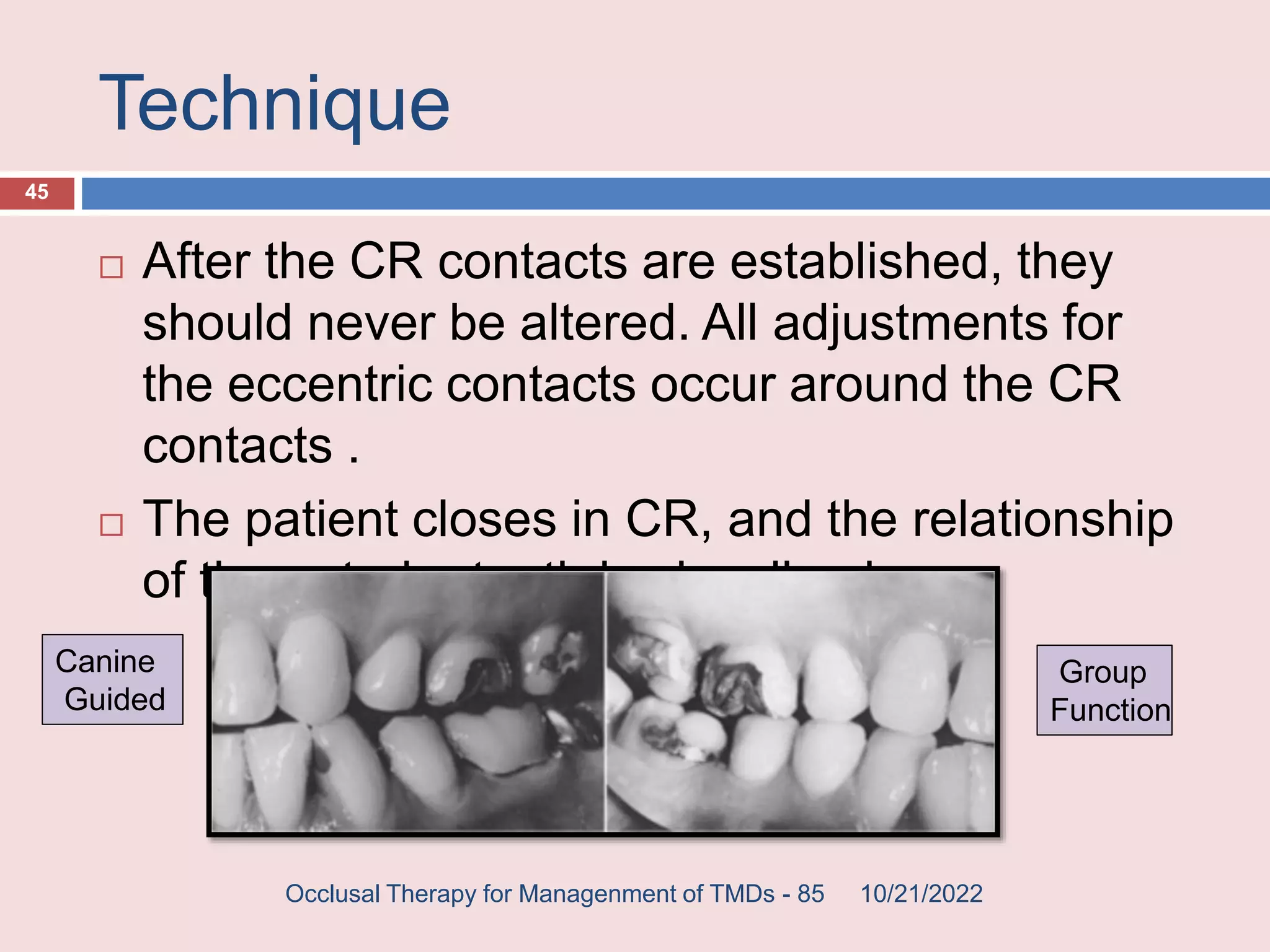 14 Occlusal therapy for management of TMDs.pptx
