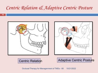 14 Occlusal therapy for management of TMDs.pptx