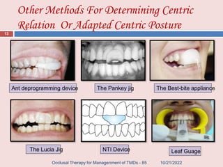 14 Occlusal therapy for management of TMDs.pptx