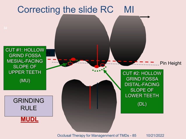 14 Occlusal therapy for management of TMDs.pptx | Physical Therapy ...