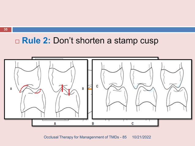 14 Occlusal therapy for management of TMDs.pptx | Physical Therapy ...