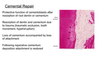 Periodontium / periodontal Ligament .ppt