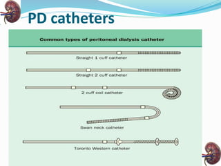 Peritoneal Dialysis Catheter Types