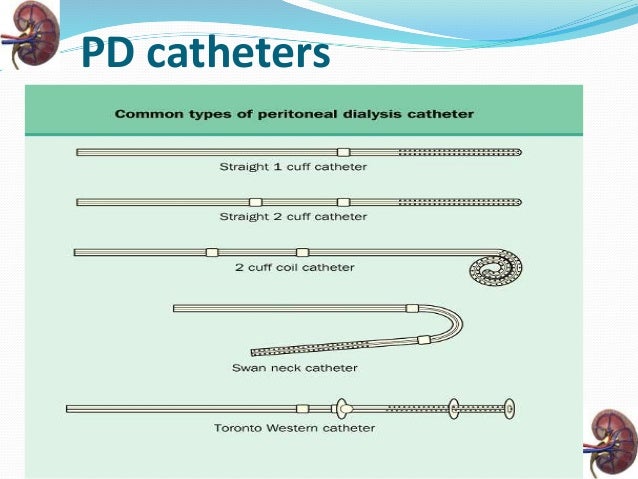 Dialysis Catheter Types