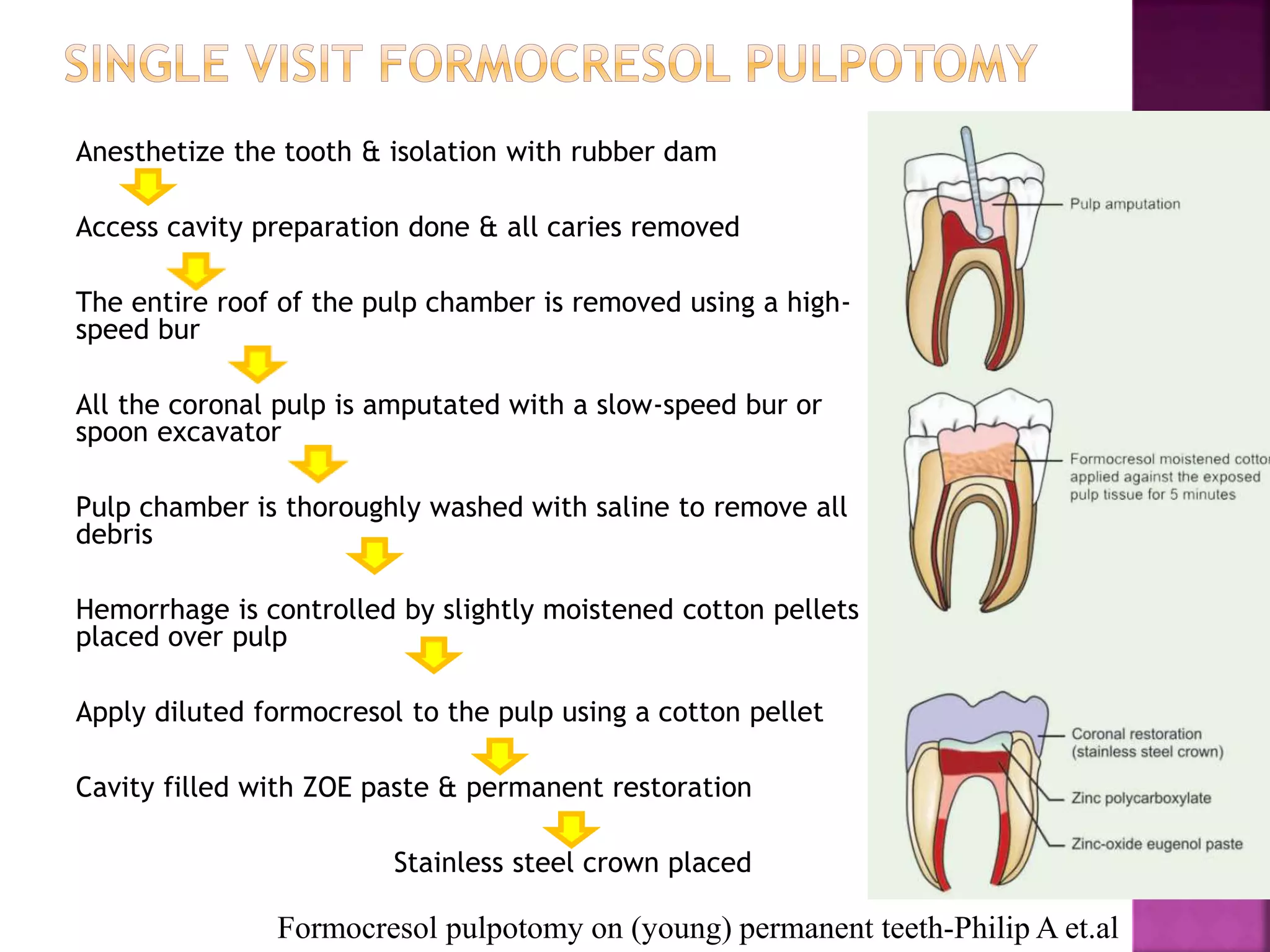 PULPOTOMY.pptx