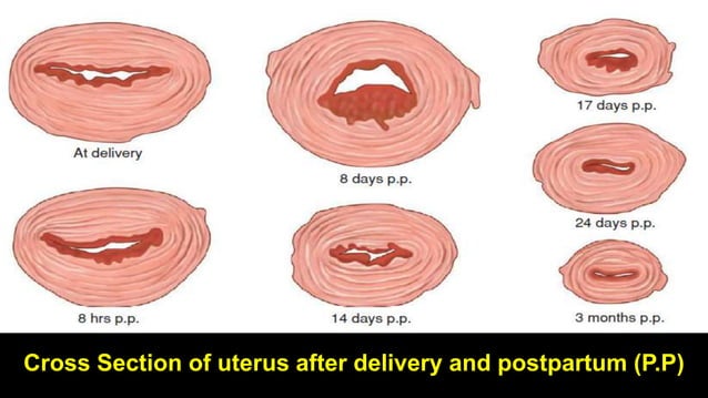 Puerperium and Postpartum Period | PPT