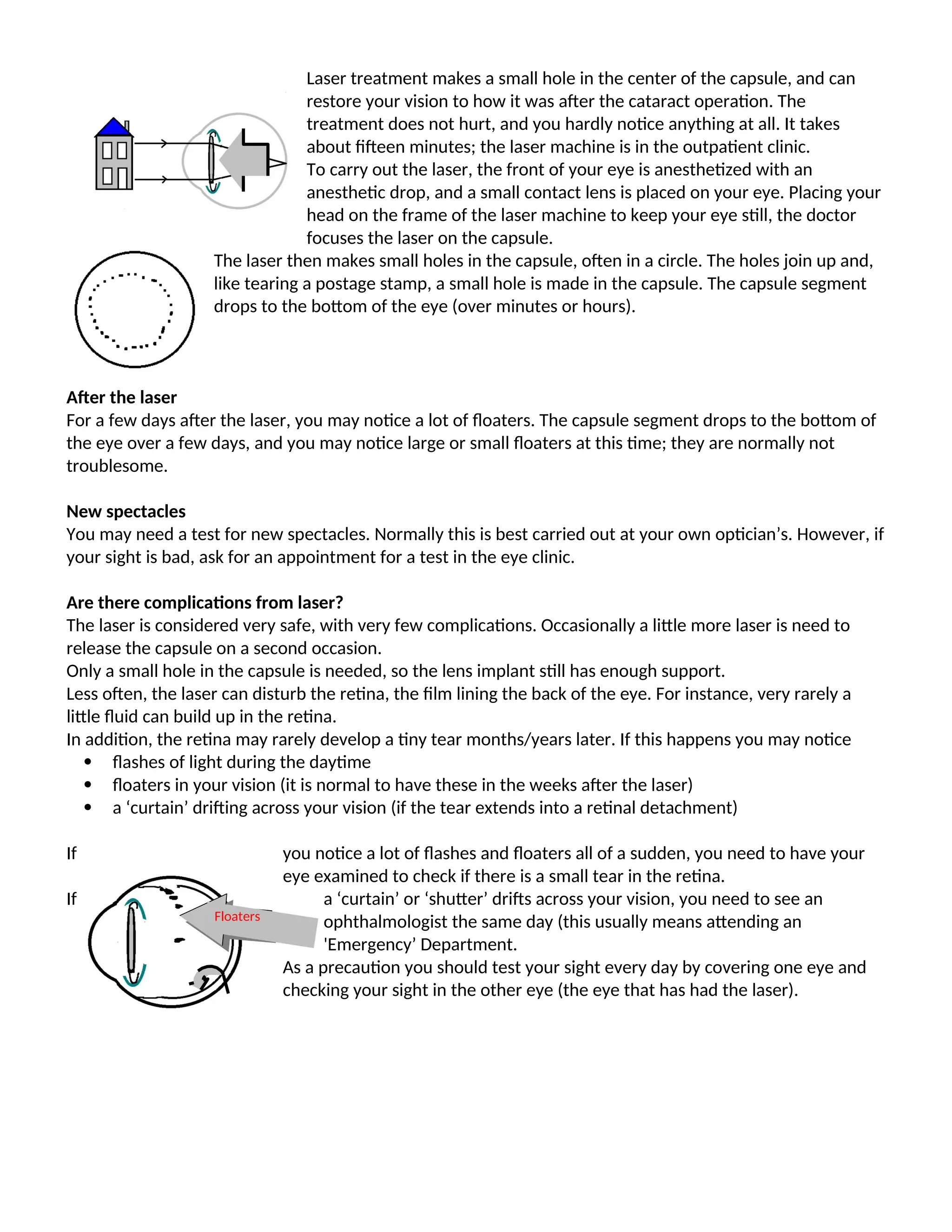 14 Thickening of the posterior capsule and laser treatment.docx