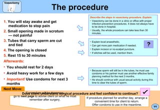 14vasectomy | PPT