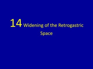 14 widening of the retrogastric space | PPT