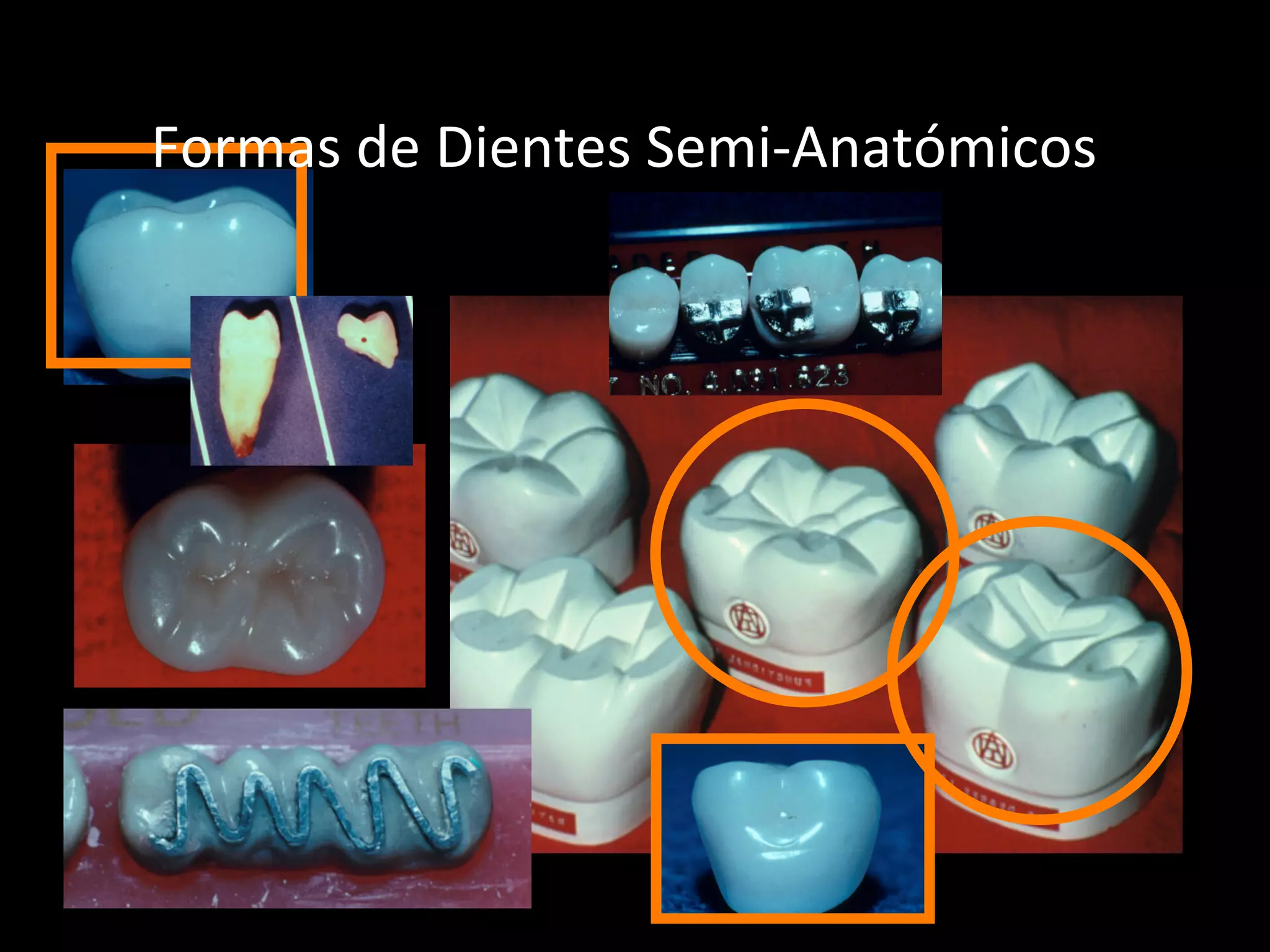 15. conceptos de oclusion esquemas oclusales | PDF