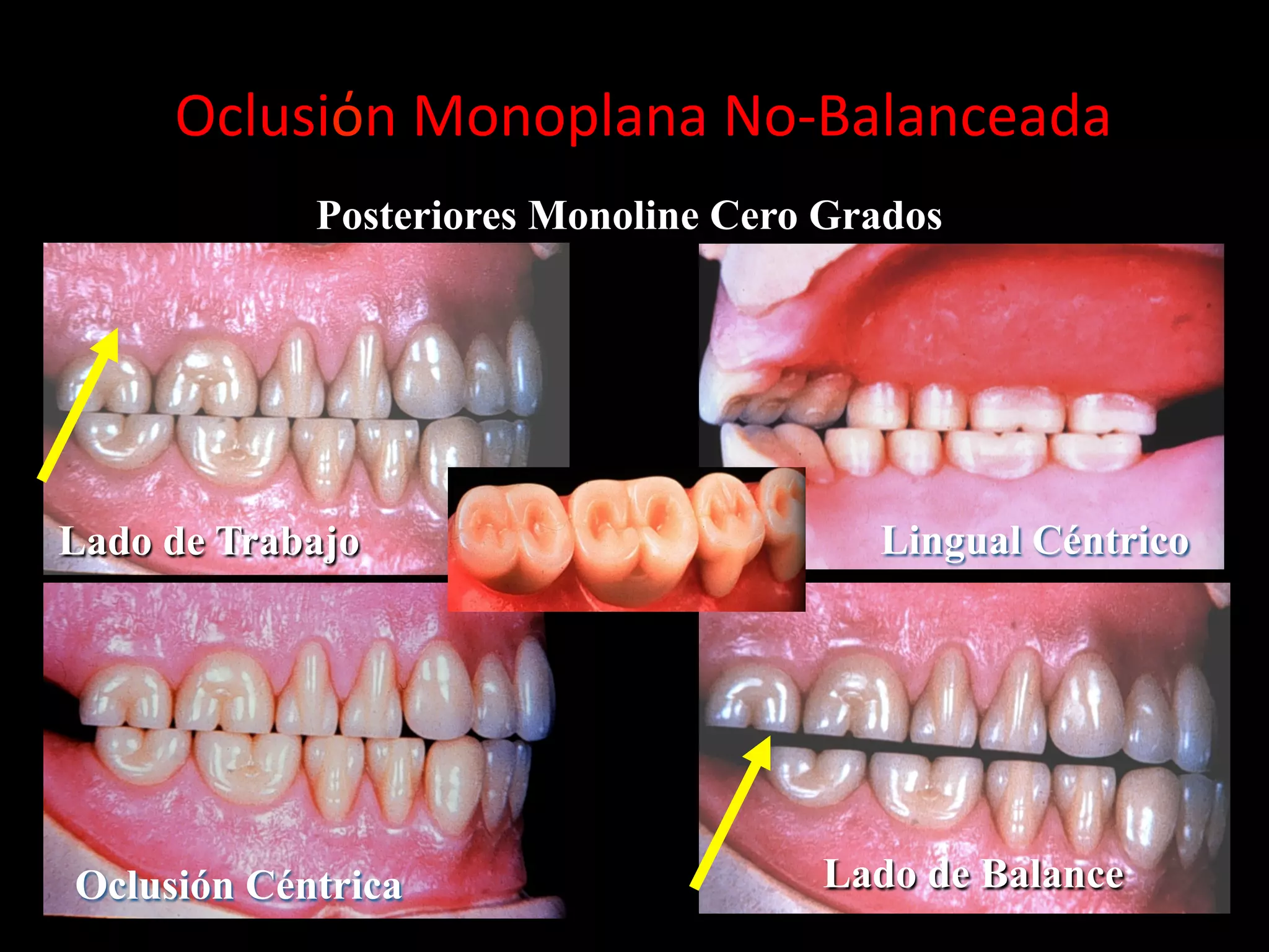 15. conceptos de oclusion esquemas oclusales | PDF