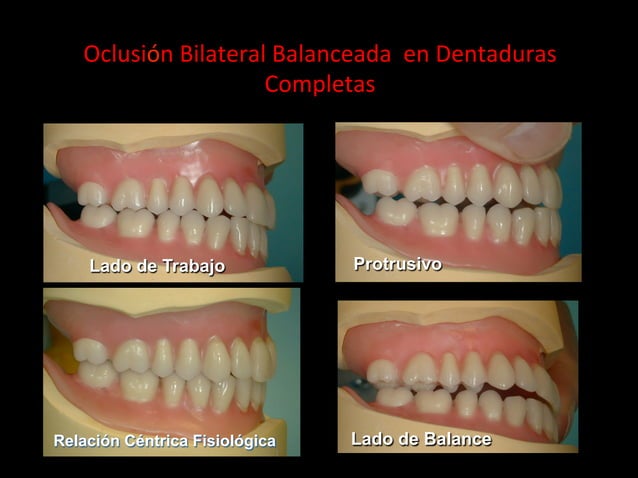 15. conceptos de oclusion esquemas oclusales | PDF