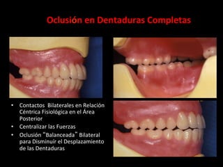 15. conceptos de oclusion esquemas oclusales | PDF