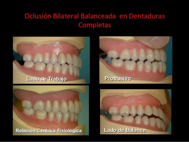 15. conceptos de oclusion esquemas oclusales