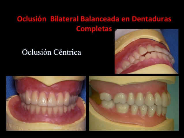 15. conceptos de oclusion esquemas oclusales