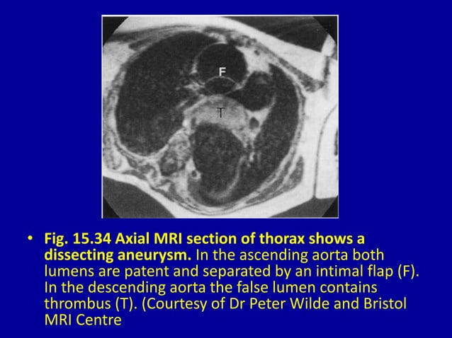 15 DAVID SUTTON PICTURES Arteriography and Intervewntional Radiology | PPTX