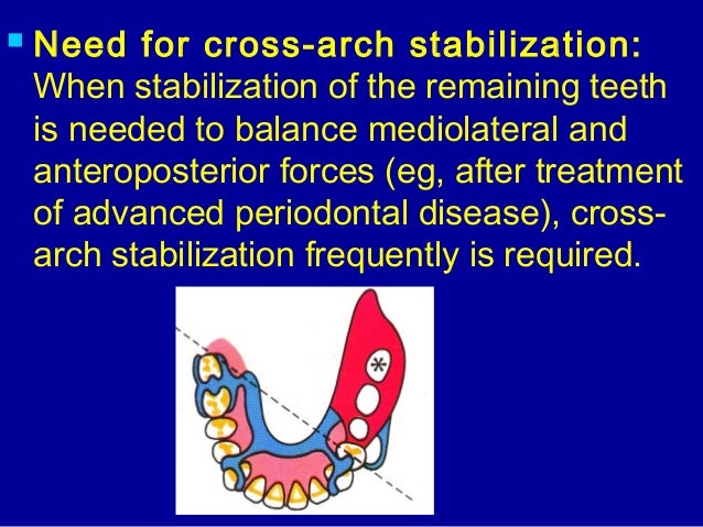 15. introduction to removable partial dentures