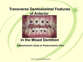 transverse dentoskeletal features of anterior open bite in the mixed ...