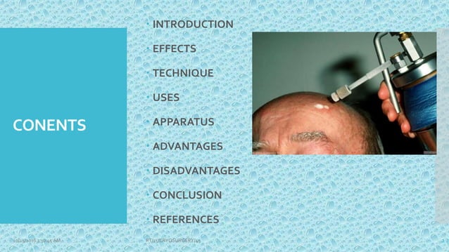 15. cryosurgery and cryotherapy (45) Dr Rahul Tiwari OMFS SIBAR ...