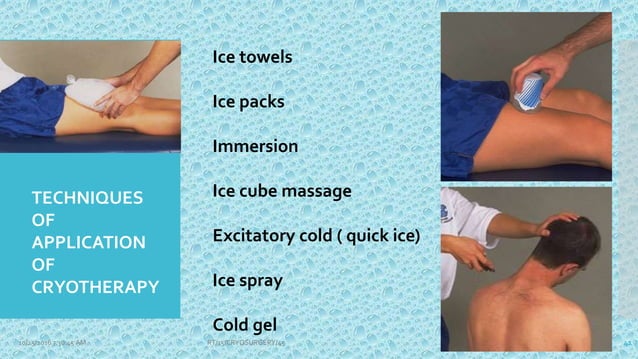 15. cryosurgery and cryotherapy (45) Dr Rahul Tiwari OMFS SIBAR ...