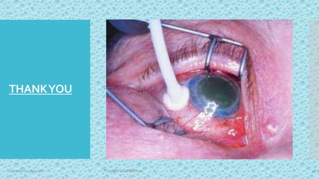 15. cryosurgery and cryotherapy (45) Dr Rahul Tiwari OMFS SIBAR ...