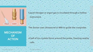 15. cryosurgery and cryotherapy (45) Dr Rahul Tiwari OMFS SIBAR ...