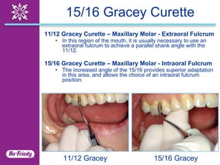 15 16 And 17 18 Gracey Fohf | PPT