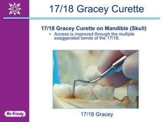 15 16 And 17 18 Gracey Fohf | PPT