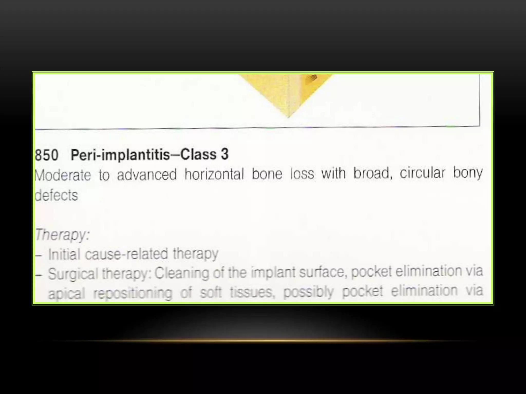 Periimplantitis | PPTX