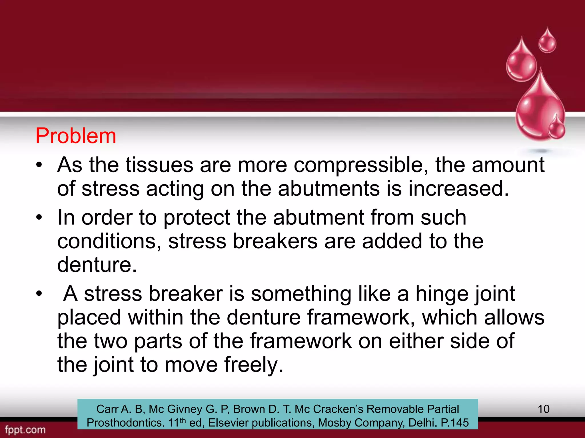 stress breakers in prosthodontics | PPTX