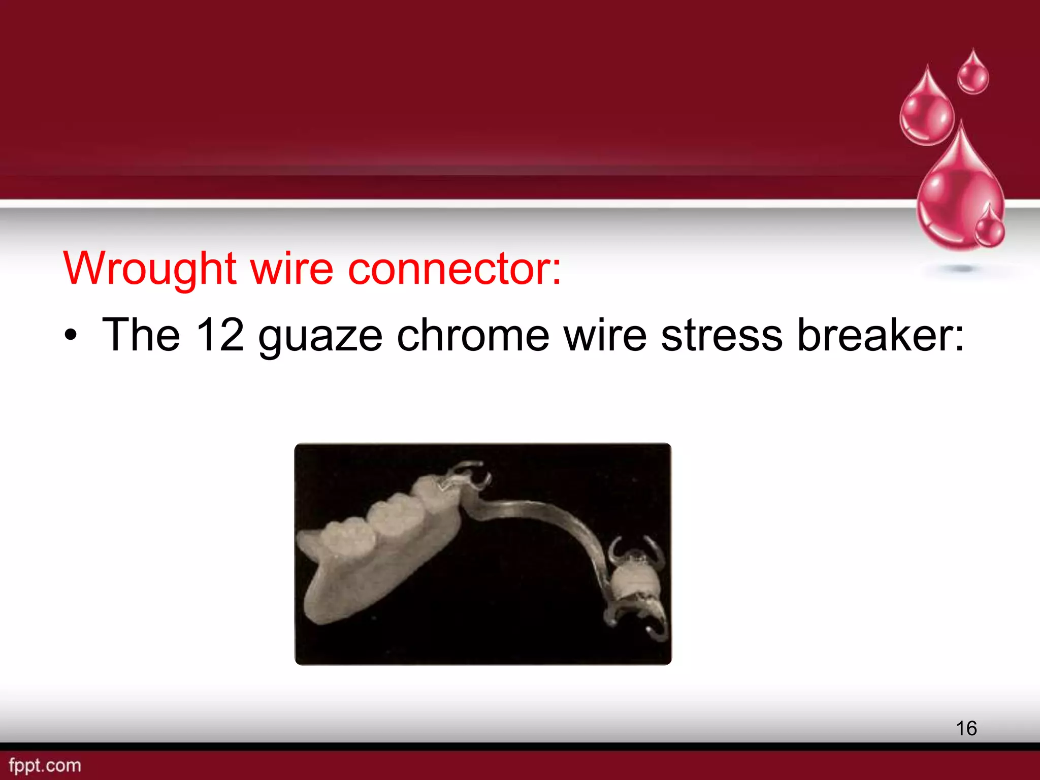 stress breakers in prosthodontics | PPTX