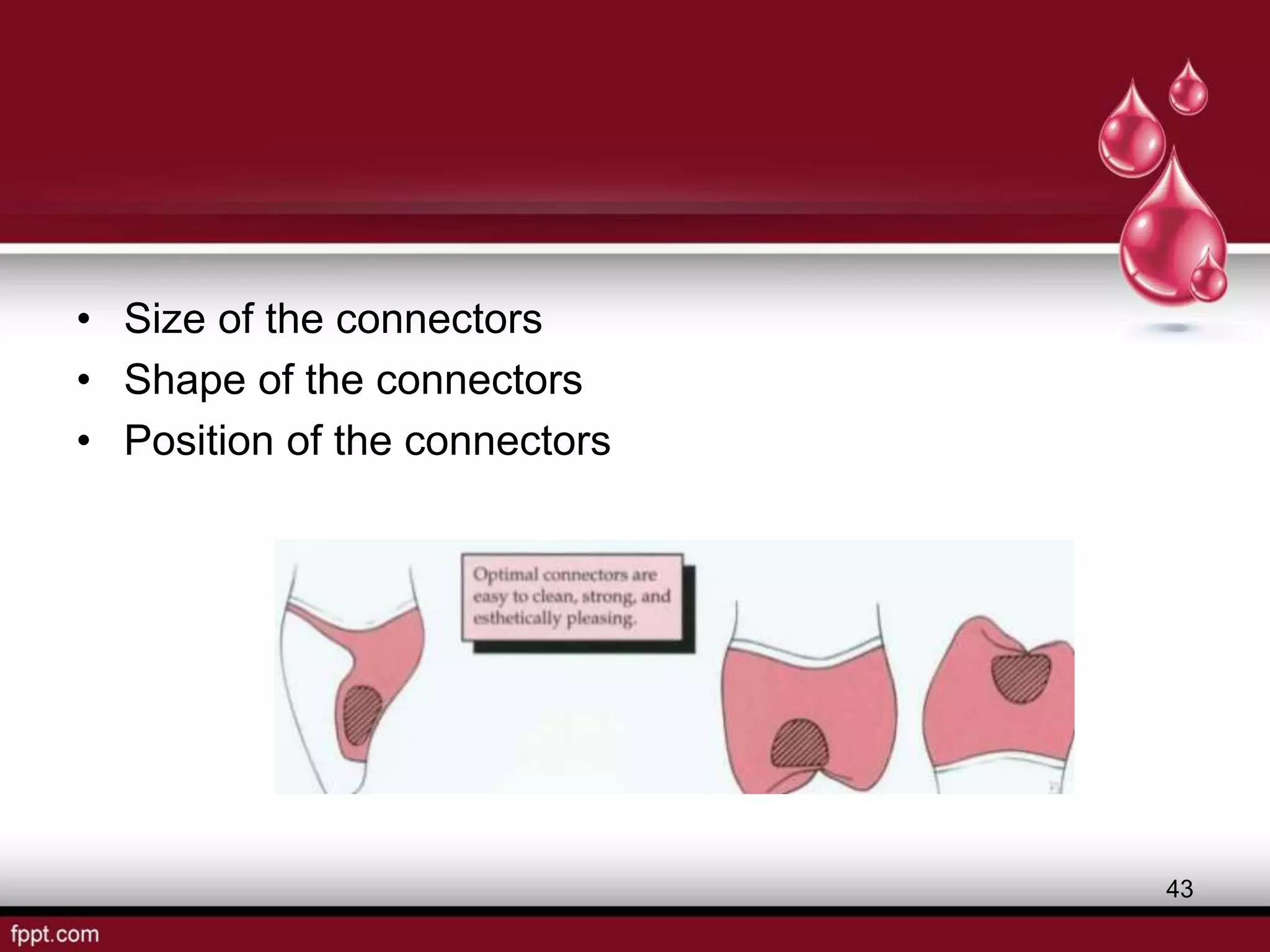 stress breakers in prosthodontics | PPTX