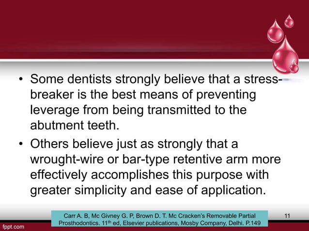 stress breakers in prosthodontics | PPTX | Dental Health | Diseases and ...
