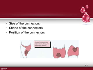 stress breakers in prosthodontics | PPTX