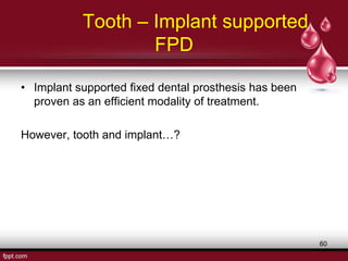 stress breakers in prosthodontics | PPTX