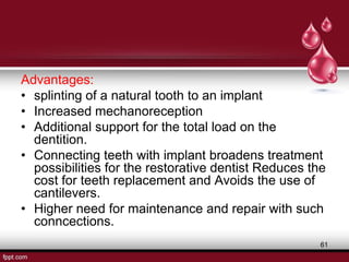 stress breakers in prosthodontics | PPTX
