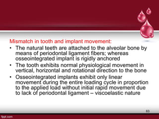stress breakers in prosthodontics | PPTX
