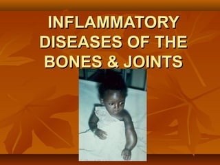 Inflammatory disease of bones | PPT