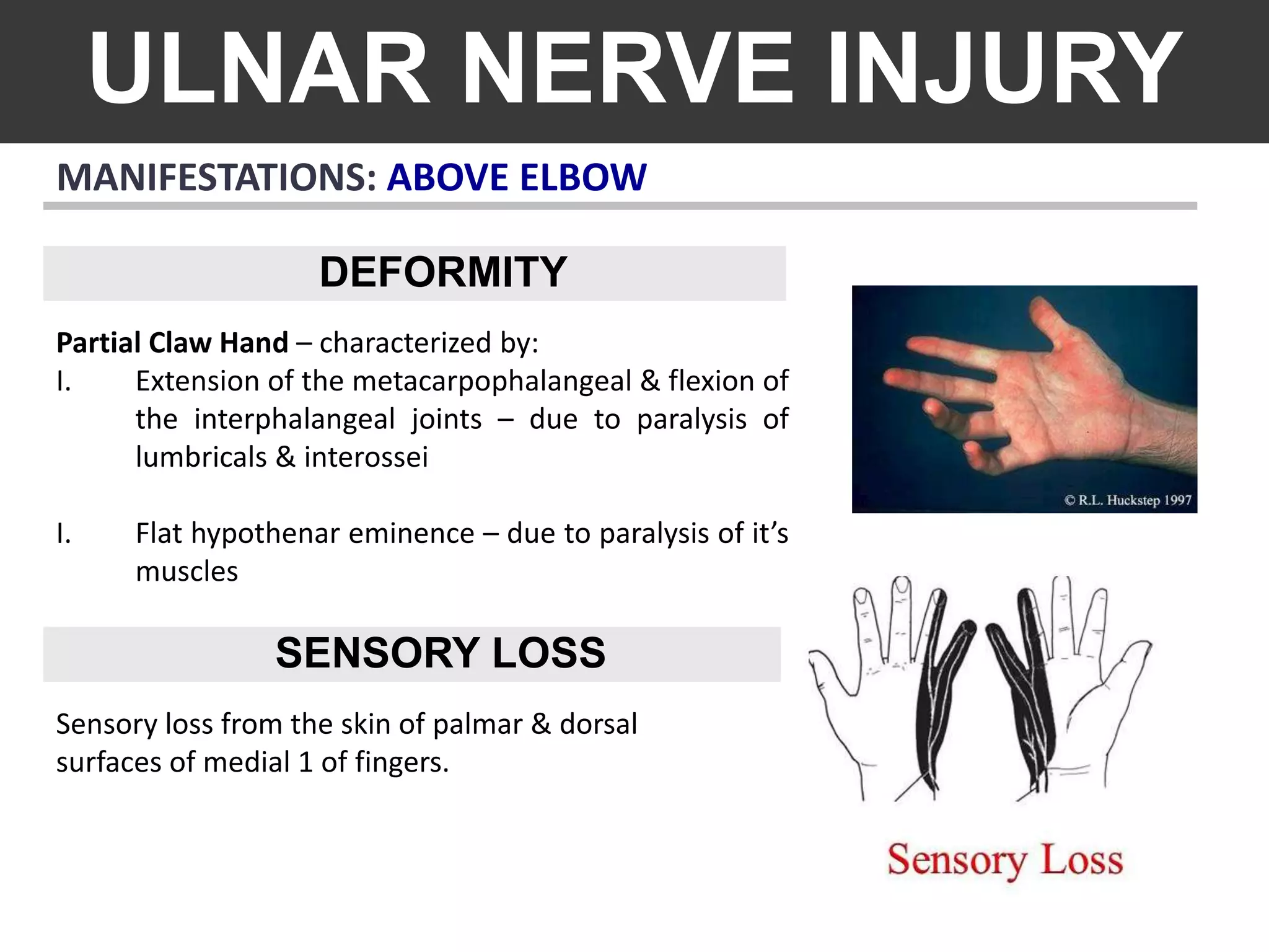 Peripheral Nerve Injuries | PPTX