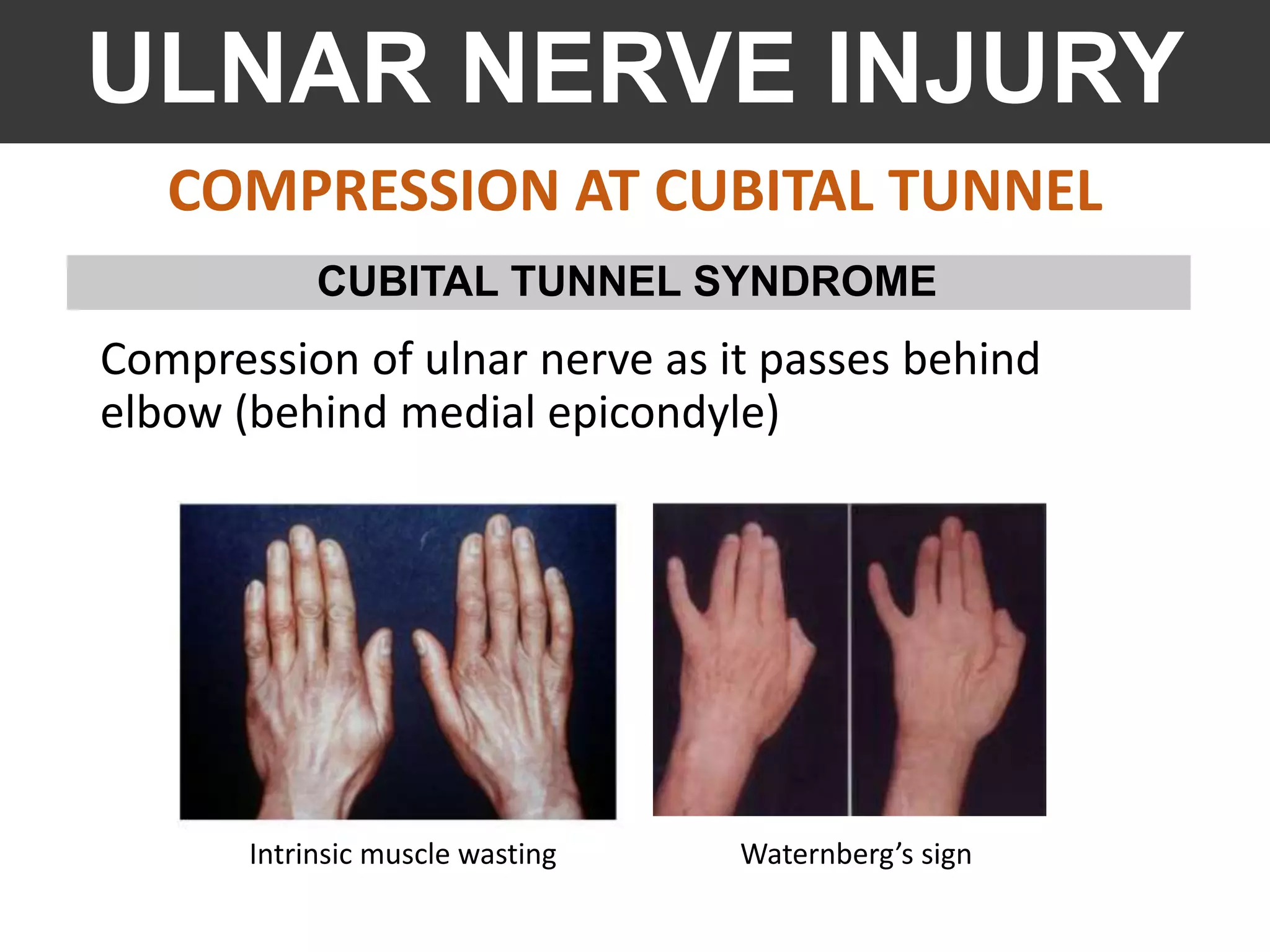 Peripheral Nerve Injuries | PPTX