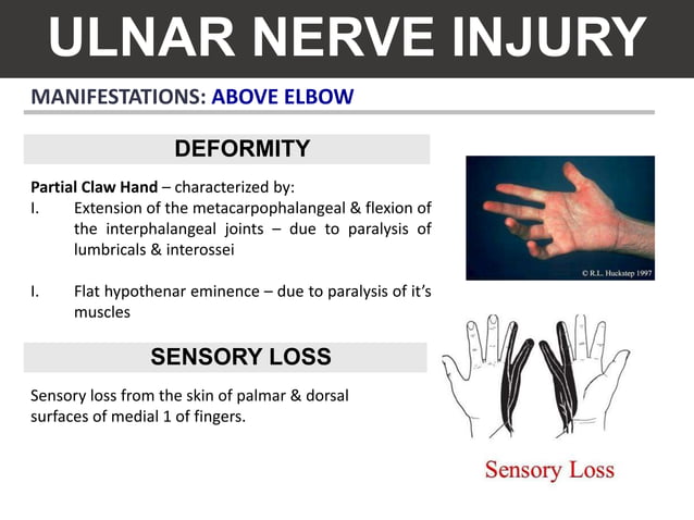 Peripheral Nerve Injuries | PPTX