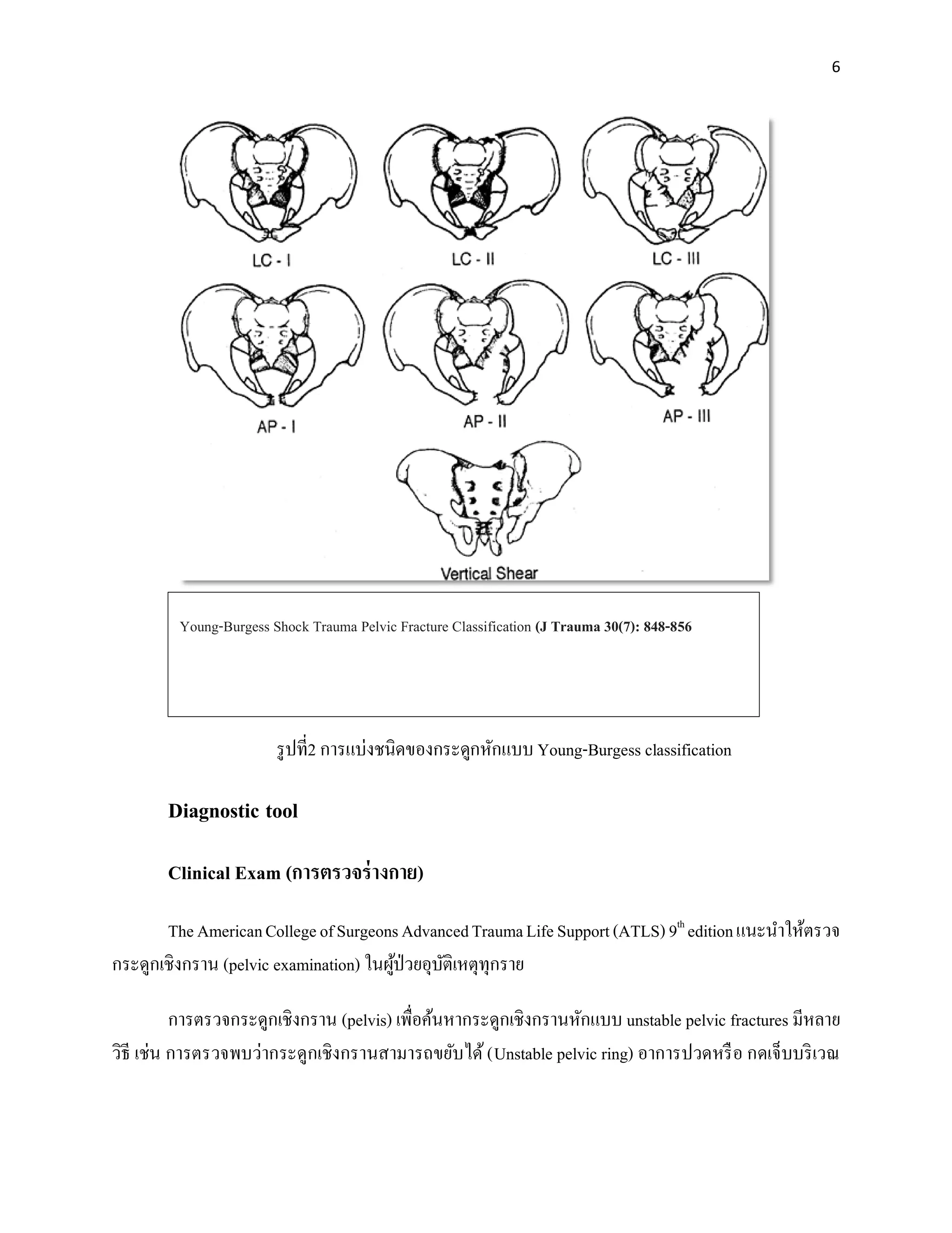 15.pelvic exsanguination (parinya 12.11.57) | PDF