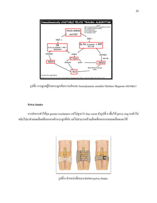 15.pelvic exsanguination (parinya 12.11.57) | PDF