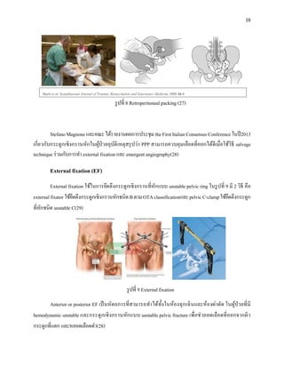 15.pelvic exsanguination (parinya 12.11.57) | PDF