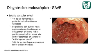 Gastropatia portal hipertensiva | PPT