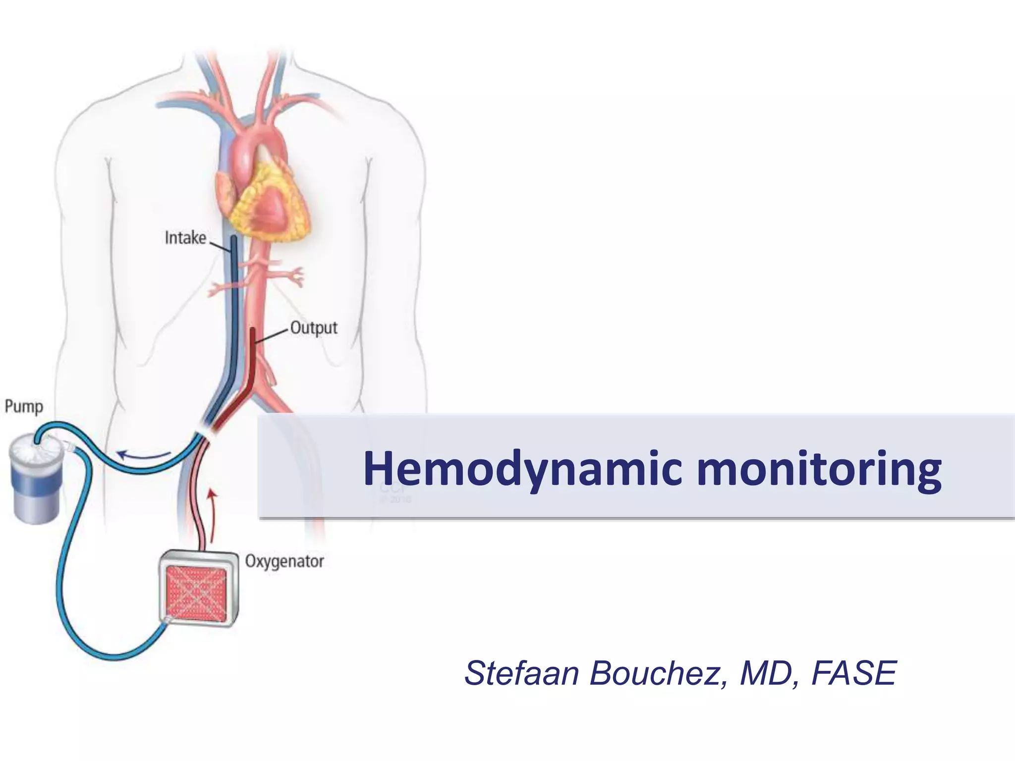 15. hemodynamic monitoring during ecmo #beach2019 (bouchez) | PPTX ...