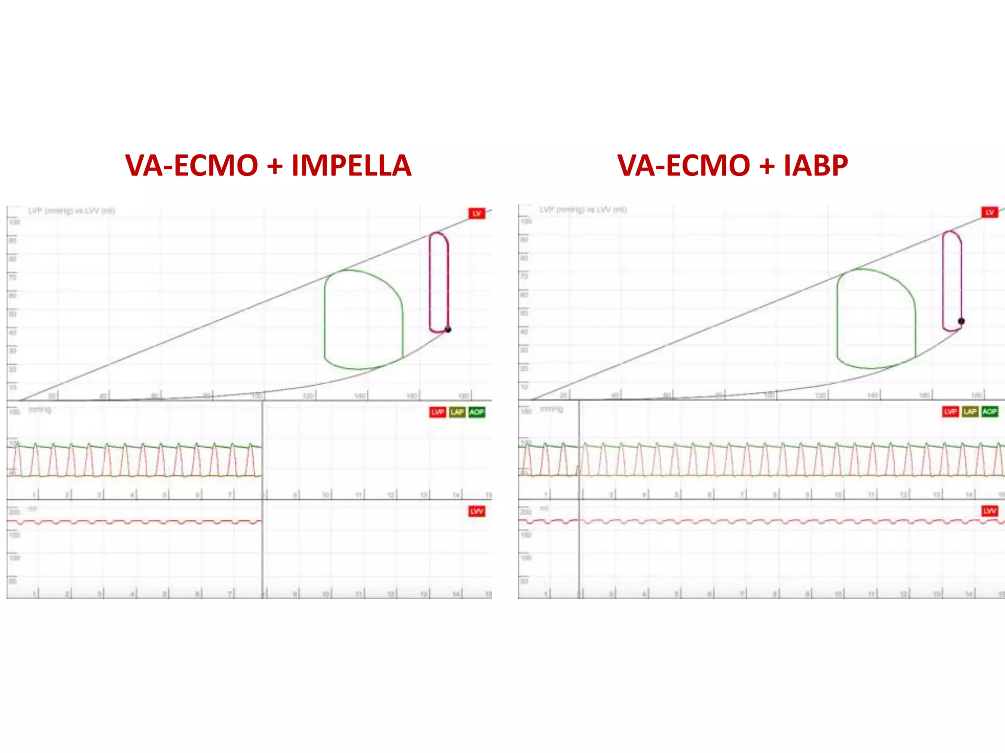 15. hemodynamic monitoring during ecmo #beach2019 (bouchez) | PPTX ...