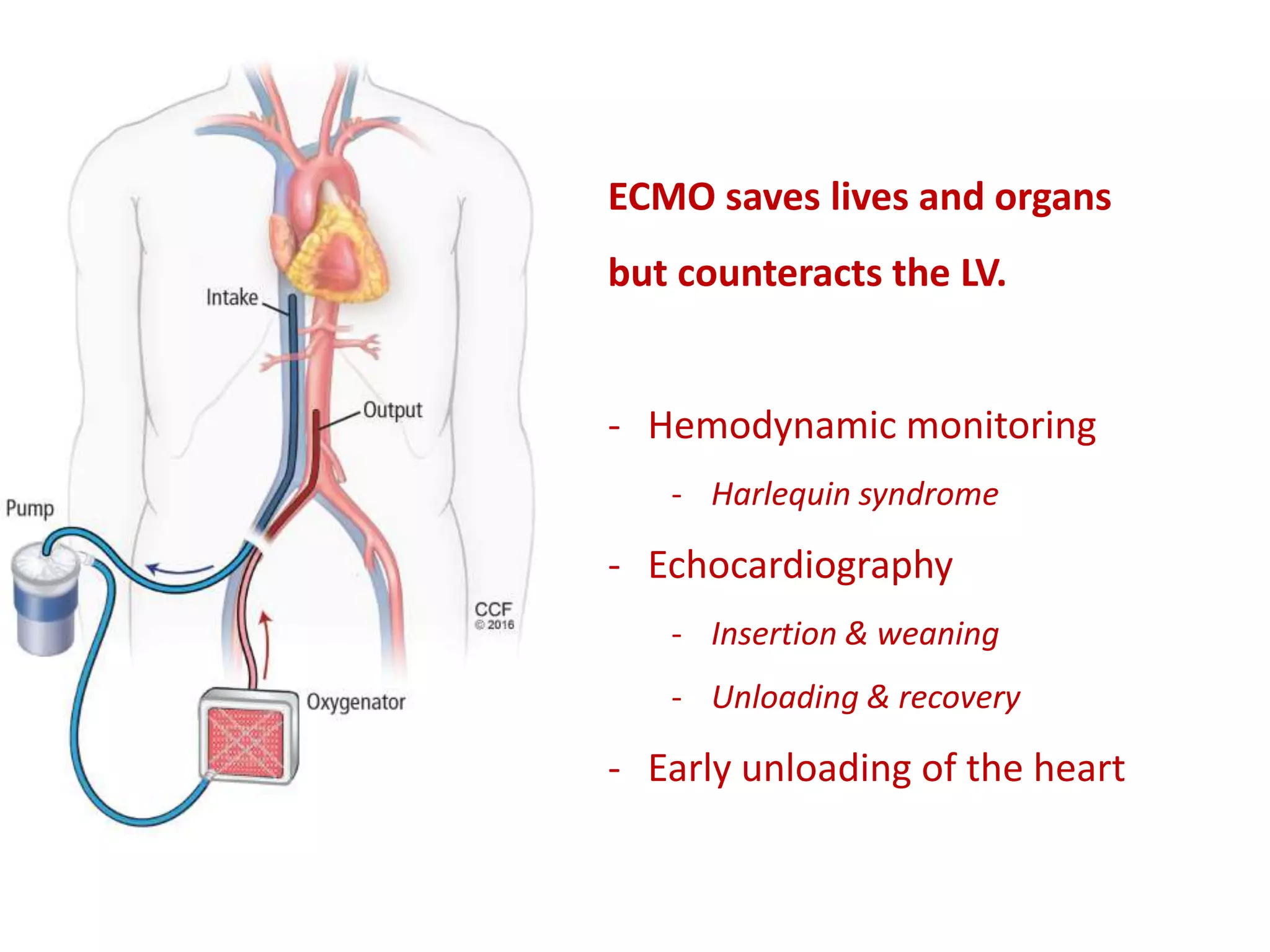 15. hemodynamic monitoring during ecmo #beach2019 (bouchez) | PPTX ...