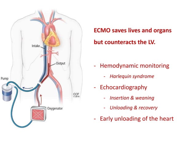 15. hemodynamic monitoring during ecmo #beach2019 (bouchez) | PPT