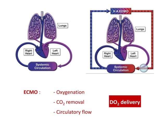 15. hemodynamic monitoring during ecmo #beach2019 (bouchez) | PPT